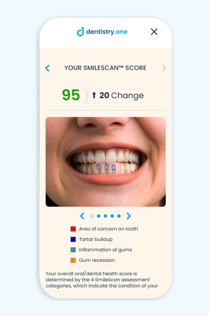 SmileScan by Dentistry.One | Try Free